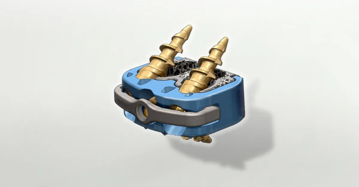 Lincotek 3D printed-enabled SpineLinc Anterior Cervical Implant System ...
