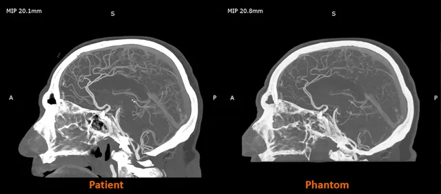 Stratasys makes RadioMatrix radiopaque 3D printing material ...